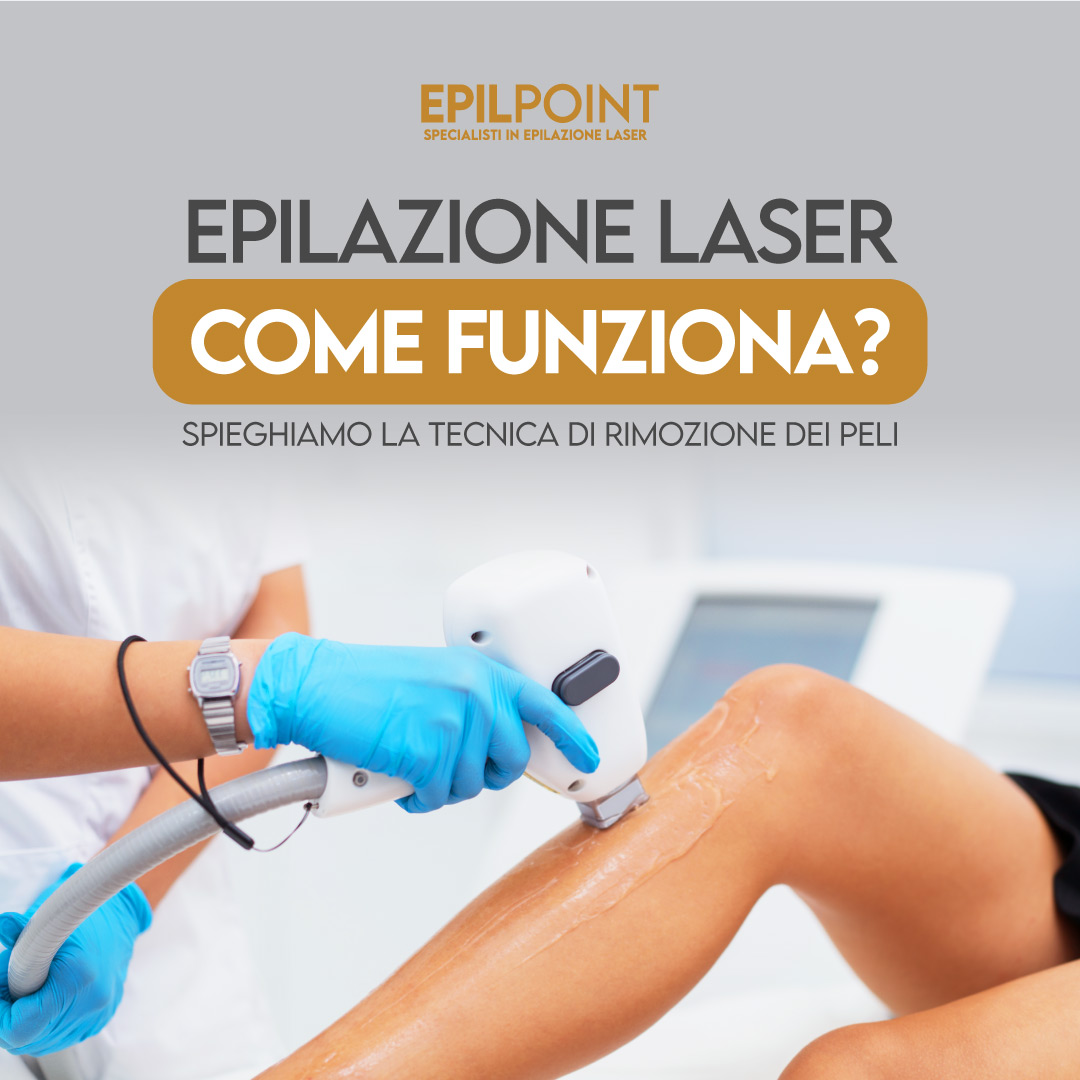 Epilazione Laser: Cos'è? Come funziona? - EPIL POINT Italia